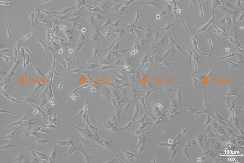 人胶质母细胞瘤细胞A172