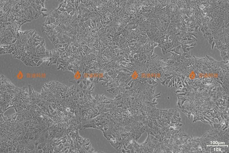 huh7.5.1（人肝癌细胞）