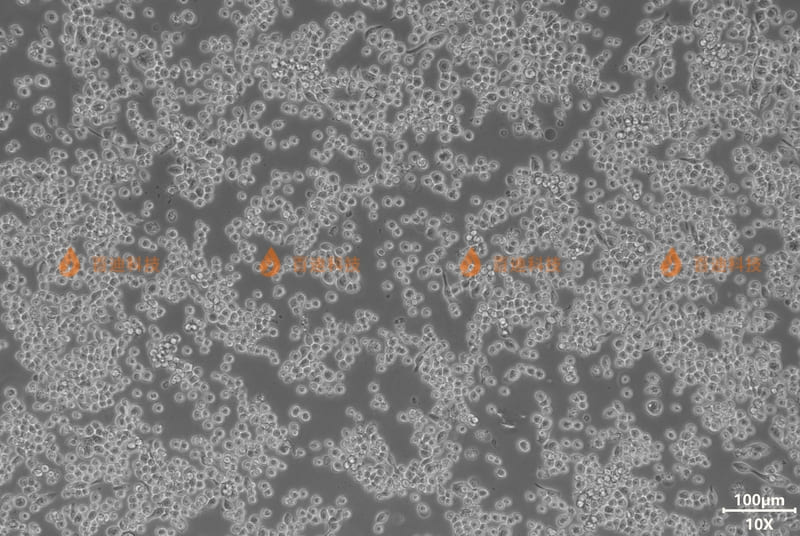 人胃癌细胞NUGC-4